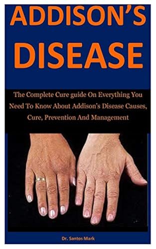 Addison's Disease: The Complete Cure guide On Everything You Need To ...