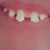 NPW Joke Fake Teeth Set - Fancy Dress Teeth Dental Disasters: Amazon.co ...