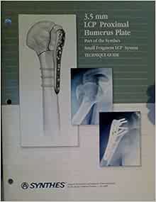 3.5 mm LCP Proximal Humerus Plate Technique Guide: Part of the Synthes ...