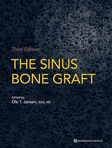 The Sinus Bone Graft, 3rd Edition in Oman | Whizz General