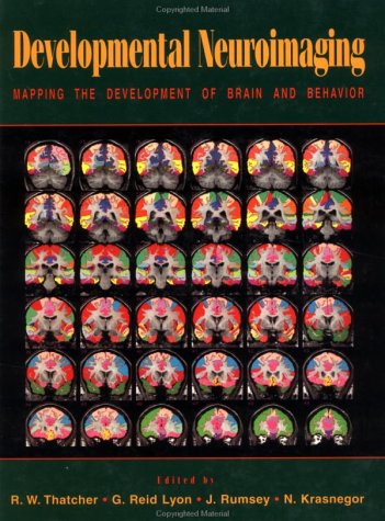 Developmental Neuroimaging: Mapping the Development of Brain and ...