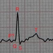Amazon | オムロンHCG-801用 心電図印刷ソフト HCG-SOFT-2 | オムロン(OMRON) | 健康家電