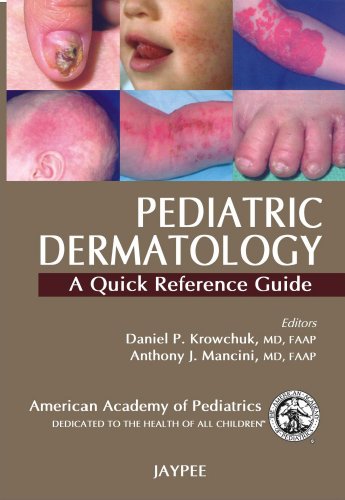 Pediatric Dermatology A Quick Reference Guide: 9788184487985: Medicine ...