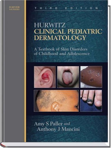 Hurwitz Clinical Pediatric Dermatology: a Textbook of Skin Disorders of Childhood and ...