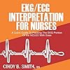 EKG/ECG Interpretation for Nurses: A Quick Guide to Passing the EKG ...