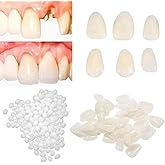 Amazon.com: Fake Tooth Repair Kits for Filling The Missing Broken Tooth ...
