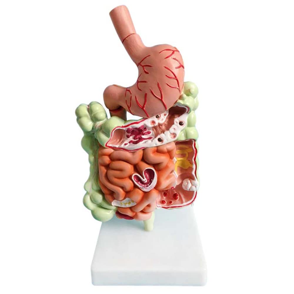 Mua Mukudlt Human Digestive System Model Stomach Anatomy Large ...