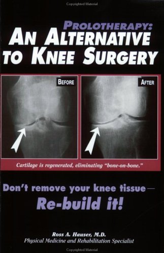 Prolotherapy: An Alternative to Knee Surgery: Hauser, Ross A., Hauser ...