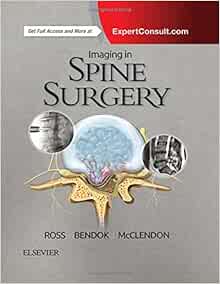 Imaging in Spine Surgery: 9780323485548: Medicine & Health Science ...