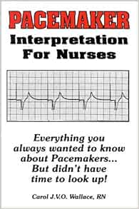 Pacemaker Interpretation for Nurses: 9780962724664: Medicine & Health ...