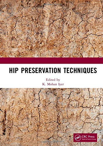 Hip Preservation Techniques: 9780367030995: Medicine & Health Science ...