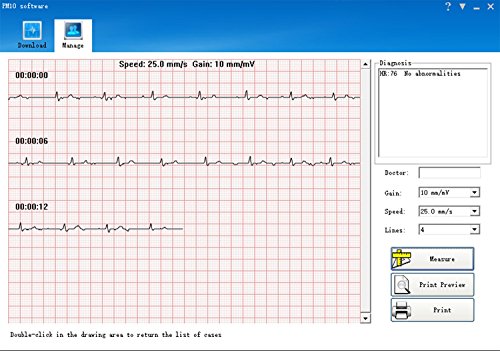 Emay Portable Handheld ECG/EKG Monitor FDA Certified PC Software for ...