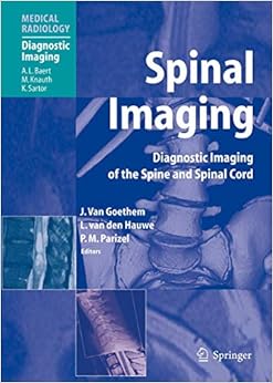 Spinal Imaging: Diagnostic Imaging of the Spine and Spinal Cord ...
