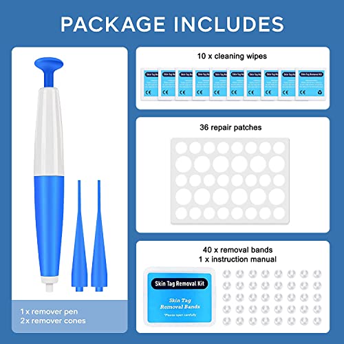 Skin Tag Remover, Skin Tag Removal Kit, Auto Tag Remover Tools, Remove ...