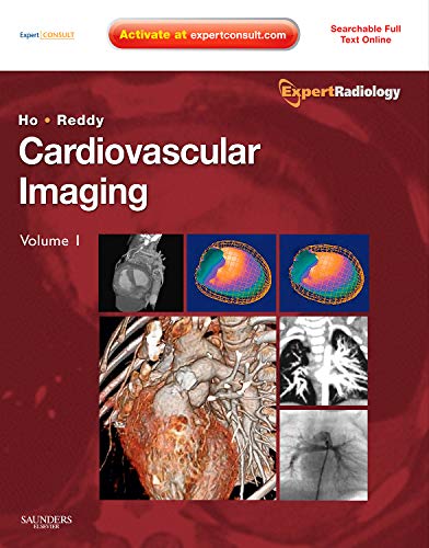 Cardiovascular Imaging, 2-Volume Set: Expert Radiology Series: Ho MD ...