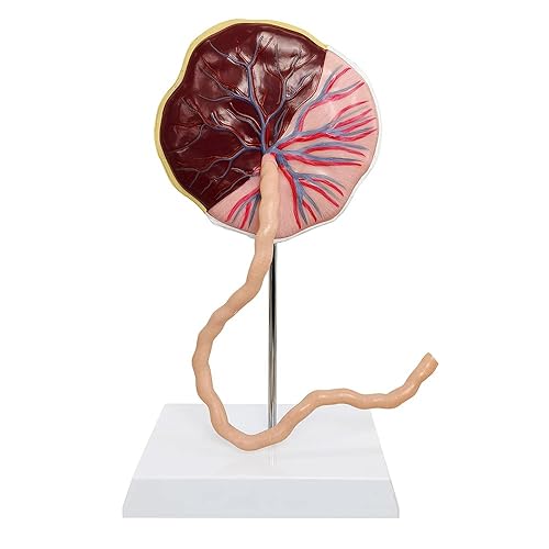 Benilev Placenta Umbilical Cord Anatomical Model, Life Size Umbilical ...