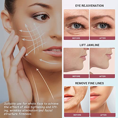 Microcurrent Face Lift Device, 2023 New Lift The Face And Tighten The ...