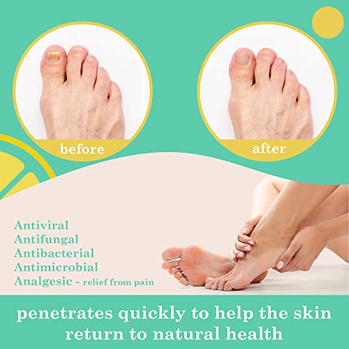 Toe Juice with DermaVine All-Natural Head to Toe Itchy Skin Relief ...