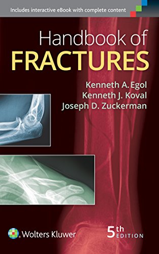Handbook of Fractures: 9781451193626: Medicine & Health Science Books ...