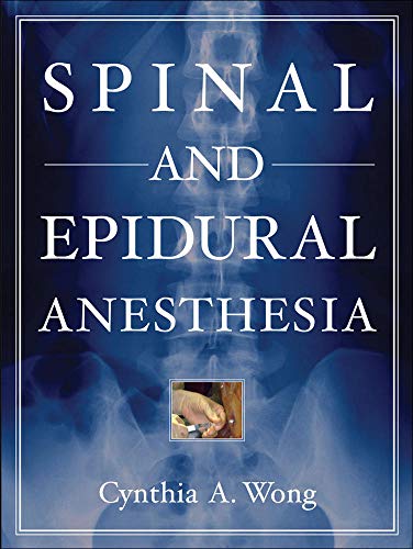 Spinal and Epidural Anesthesia: 9780071437721: Medicine & Health ...