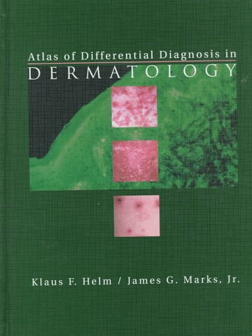 Atlas of Differential Diagnosis in Dermatology: 9780443056055: Medicine ...