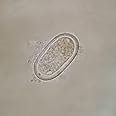 Amazon.com: Enterobius Vermicularis Eggs, W.M. Microscope Slide ...