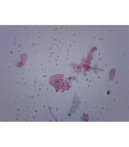 Amoeba Proteus Under Microscope Unicellular Amoeba Motion Under