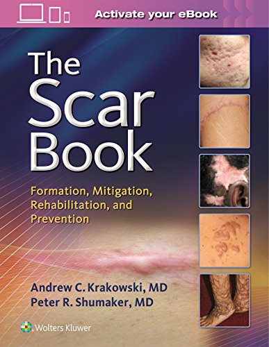 The Scar Book: Formation, Mitigation, Rehabilitation and Prevention ...