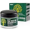 Tea Tree Oil Psoriasis Eczema Treatment Cream - Lasting Soothing and ...