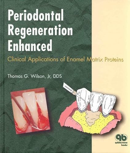 Periodontal Regeneration Enhanced: Clinical Applications of Enamel ...