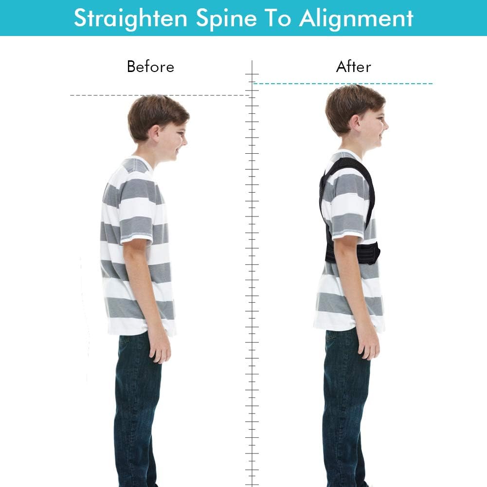 Posture Corrector for Kids Teenagers, Spinal Support Back Posture Brace ...