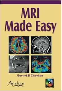 MRI Made Easy: 9781905740611: Medicine & Health Science Books @ Amazon.com