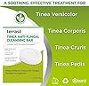 Tinea Soap for Tinea Versicolor Relief – Natural Anti-Fungal Medicated ...