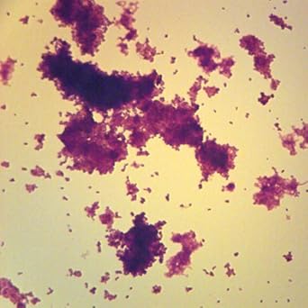 Mixed Gram-Positive & Gram-Negative Coccus, w.m. Gram Stain Microscope ...