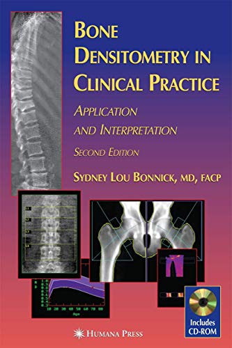 Bone Densitometry in Clinical Practice: Application and Interpretation ...
