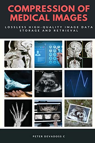 Compression of Medical Images - Lossless High Quality Image Data ...