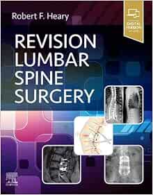 Revision Lumbar Spine Surgery: 9780323712019: Medicine & Health Science ...