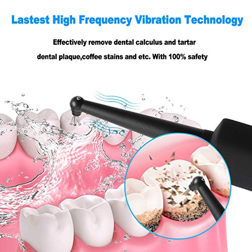 Electric Dental Spotzie Calculus Plaque Remover for Teeth,Tooth Cleaner ...