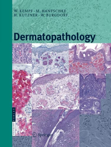 Dermatopathology: 9783662526873: Medicine & Health Science Books ...