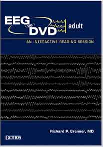 EEG on DVD - Adult: An Interactive Reading Session: Brenner MD, Richard ...