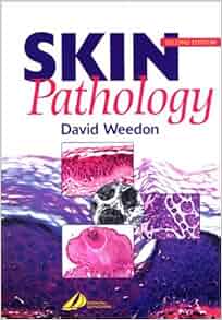 Skin Pathology: 9780443070693: Medicine & Health Science Books @ Amazon.com