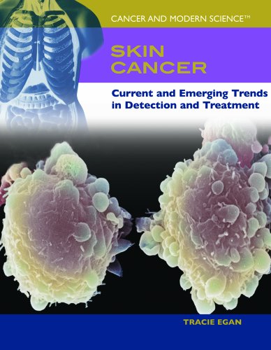 Skin Cancer: Current And Emerging Trends in Detection And Treatment ...