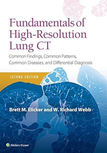 Fundamentals of High-Resolution Lung CT: Common Findings, Common ...