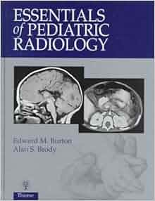 Essentials of Pediatric Radiology: 9780865778023: Medicine & Health ...