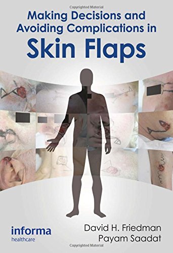 Making Decisions and Avoiding Complications in Skin Flaps ...