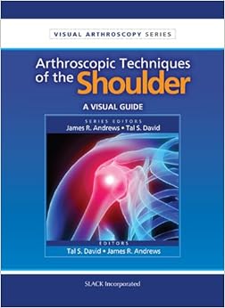 Buy Arthroscopic Techniques of the Shoulder: A Visual Guide (Visual ...