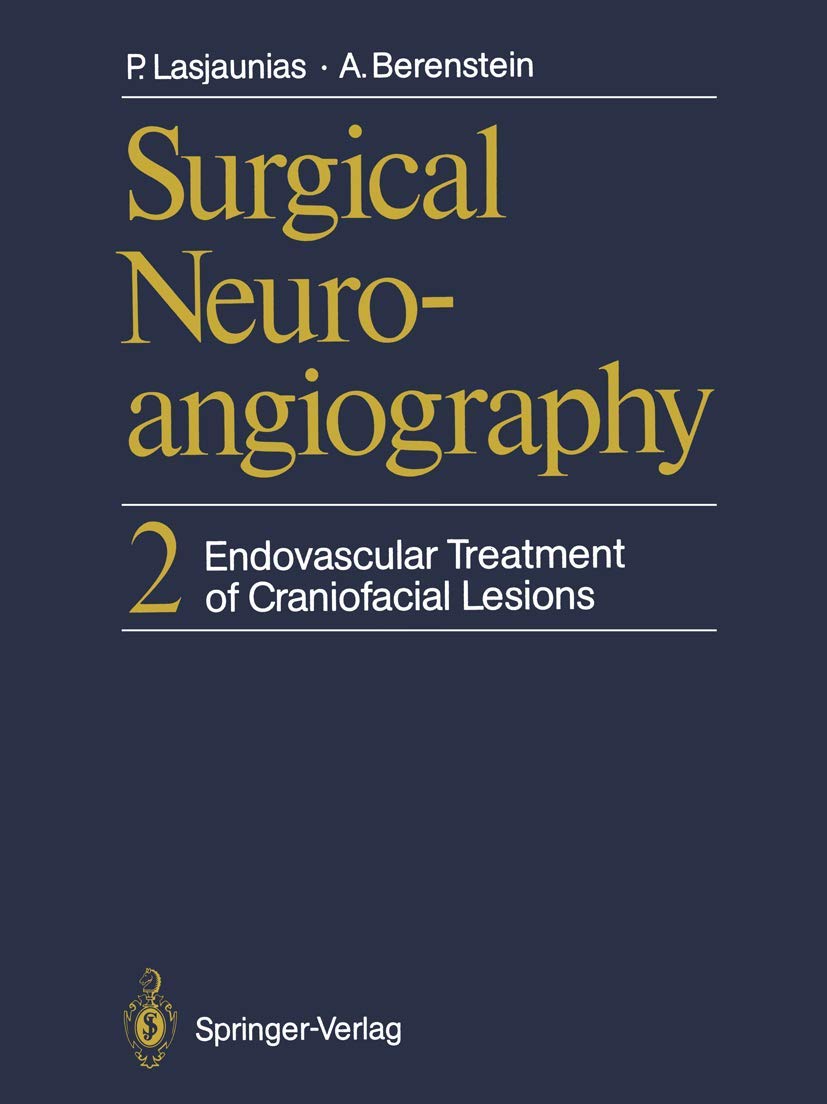 Mua Surgical Neuroangiography: 2 Endovascular Treatment of Craniofacial ...