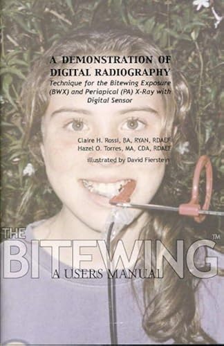 A DEMONSTRATION OF DIGITAL RADIOGRAPHY Technique for the Bitewing ...