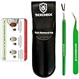 TickCheck Premium Tick Remover Kit - Stainless Steel Tick Remover ...