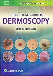 A Practical Guide to Dermoscopy: 9781451192636: Medicine & Health ...